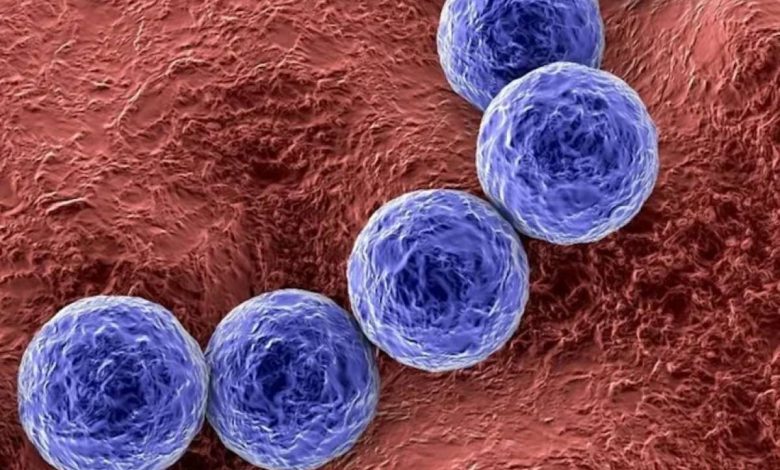 Argentina: 64 muertos por bacteria Streptococcus pyogenes - Si se puede ...